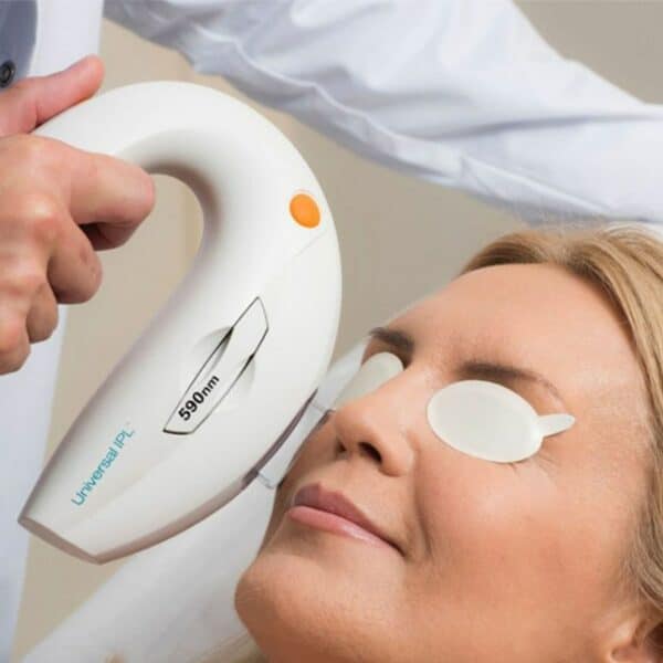Sun Damage & Sun Spot Removal | London Premier Laser Clinic