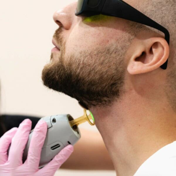 Ingrown Hair Removal | London Premier Laser Clinic