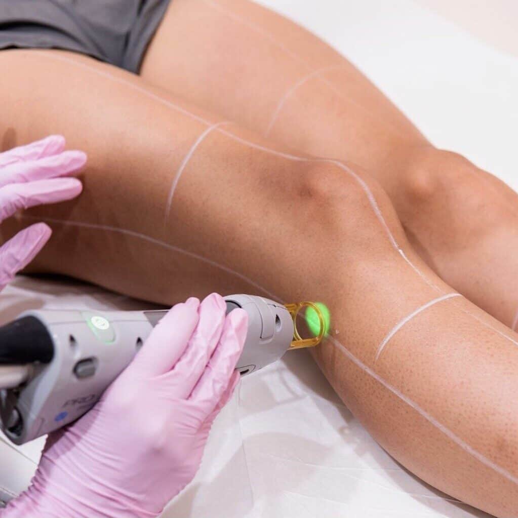 Laser Hair Removal London London Premier Laser And Skin Clinic