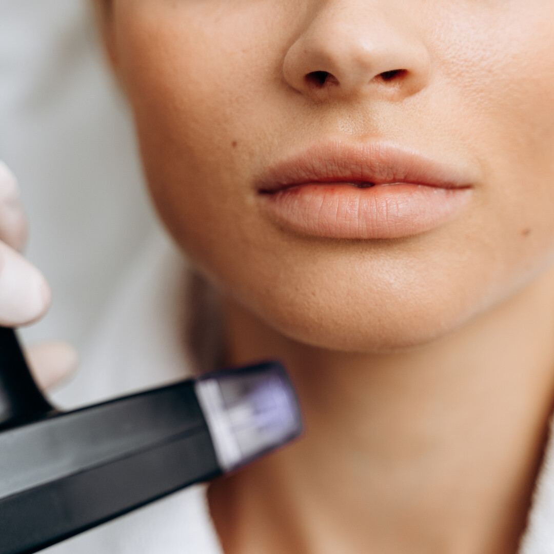 Skin Tightening | London Premier Laser Clinic