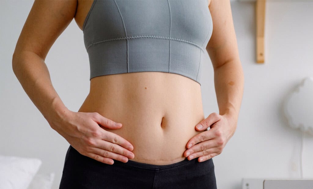 Does Morpheus8 Melt Fat in the Stomach? - London Premier Laser & Skin ...