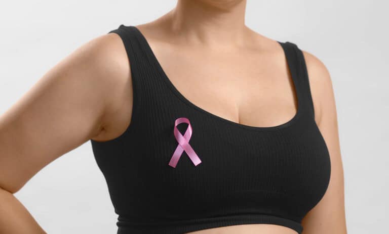 Is Laser Hair Removal Safe for Breast Cancer Survivors? - London ...
