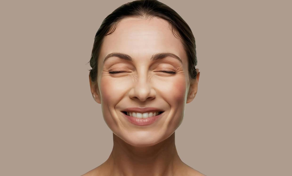 When I Smile, I Have Wrinkles Under My Eyes - London Premier Laser ...