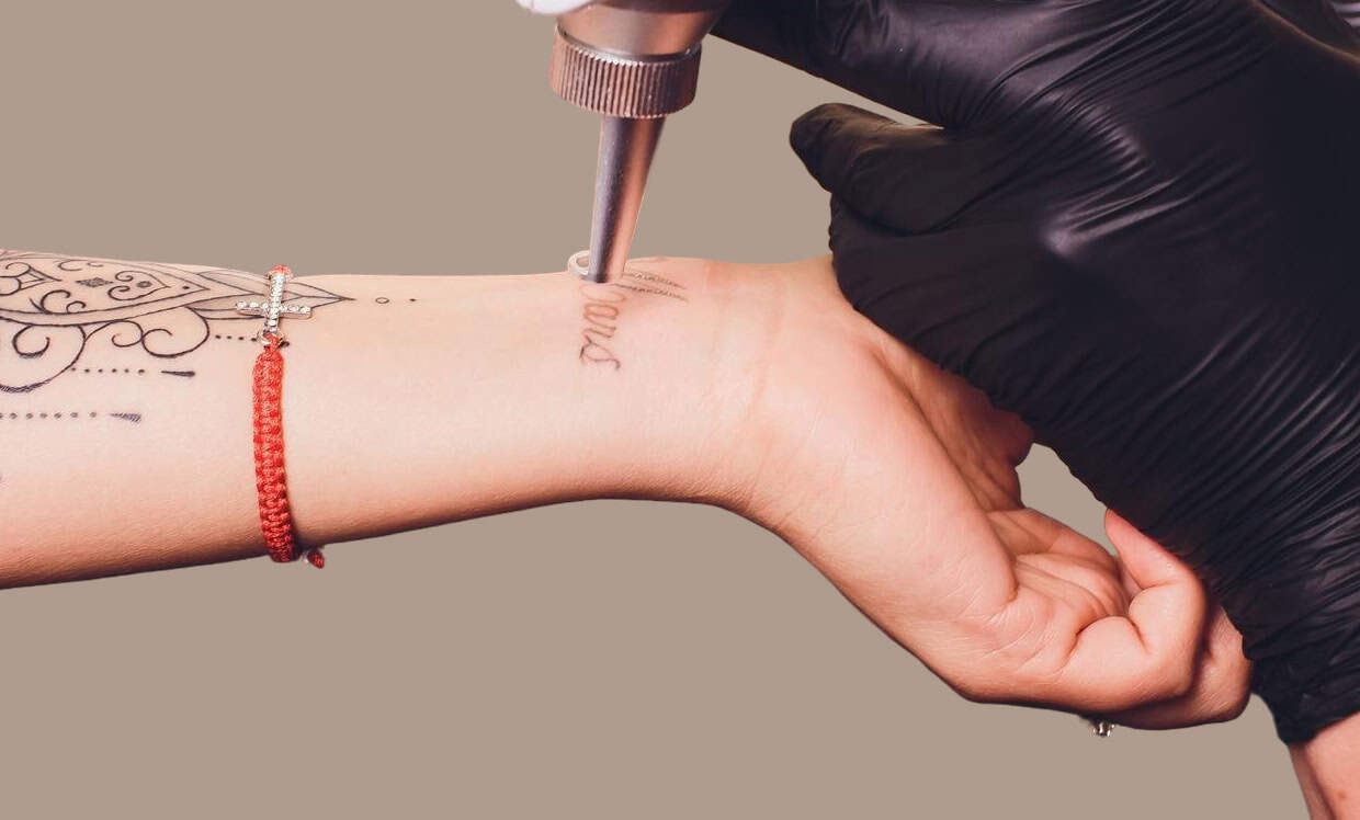 Do All Colours Fade with Laser? - London Premier Laser & Skin Clinic